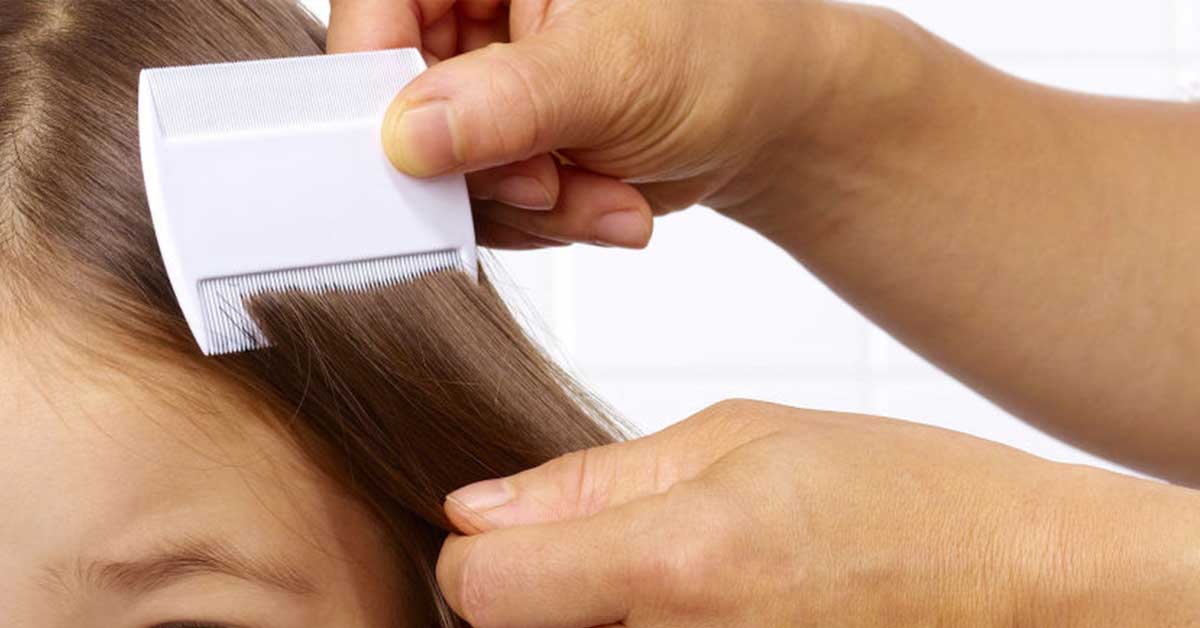 Pettine per pidocchi: elettrico o classico come scegliere ...